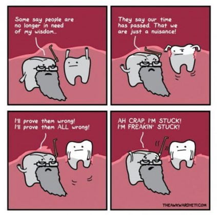 25 Wisdom Teeth Memes That Are Too Funny For Words - SayingImages.com
