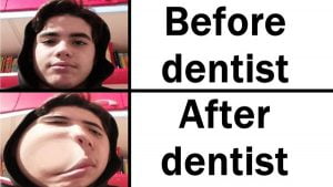 30 Dentist Memes That Are Seriously Funny - SayingImages.com