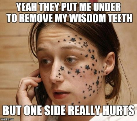 25 Wisdom Teeth Memes That Are Too Funny For Words - SayingImages.com